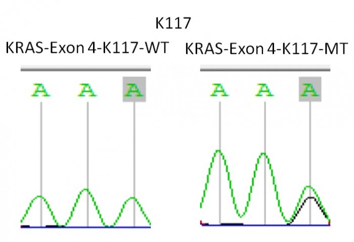 KRAS Exon 4 Primer Set (A) - FemtoPath | HongJing弘晉