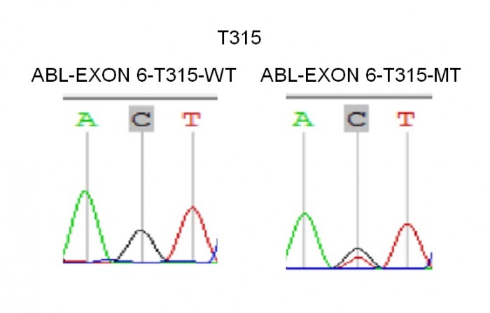ABL Exon 6 Primer Set (A) - FemtoPath | HongJing弘晉