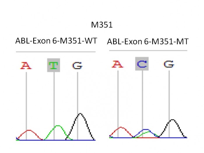 ABL Exon 6 Primer Set (B) - FemtoPath | HongJing弘晉