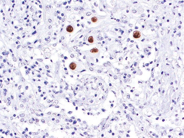 Cytomegalovirus (CMV) Antibody - FemtoPath | HongJing弘晉