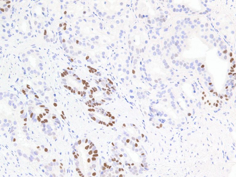 c-Myc Antibody - FemtoPath | HongJing弘晉